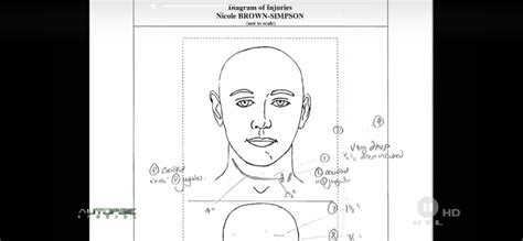 Why Does This Autopsy Report Of Nicole Brown Simpson Look A Bald Harry