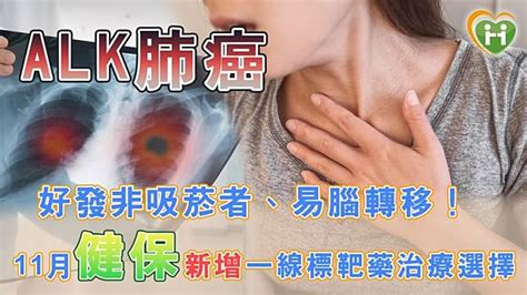 Alk肺癌好發非吸菸者、易腦轉移！ 11月健保新增一線標靶藥治療選擇 健康醫療網 Line Today