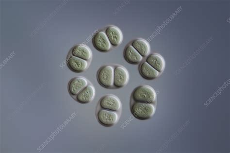 Chrococcus Sp Cyanobacteria Light Micrograph Stock Image C056 8326 Science Photo Library