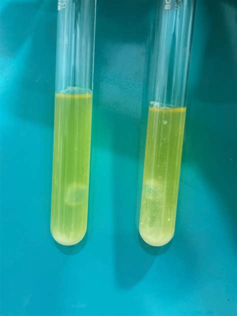 Ec Broth Key To Identifying E Coli In Water Food And Environmental Samples Anagha M Raj