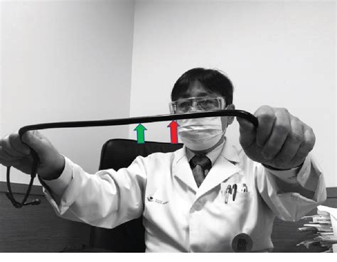Figure 1 From Unilateral Spatial Neglect Due To Stroke Semantic Scholar