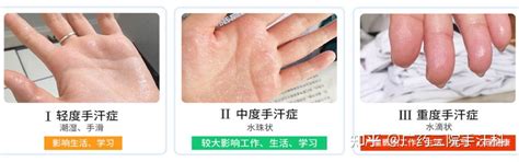 摆脱手汗淋漓还你干爽双手 知乎