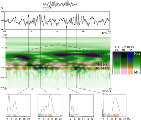 If The Eeg Record Reveals Evidence Of Sleep Spindles At Horace Gant Blog