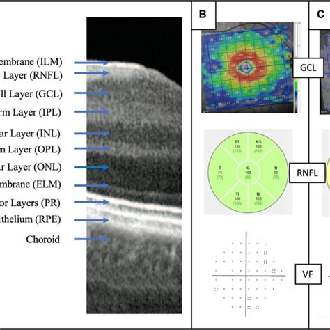 Retinal Layers Retina Is Formed By 10 Layers From The Inner To The
