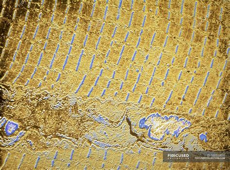 False Colour Transmission Electron Micrograph Tem Of Human Striated