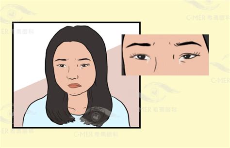 眼屎粘稠可能是眼睛在求救有这4个症状小心眼睛亮红灯 知乎