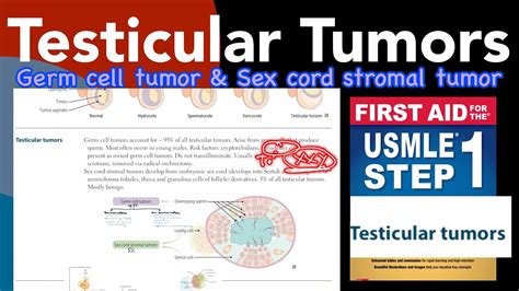 Testicular Tumors Germ Cell Tumor And Sex Cord Stromal Tumours In Hindi
