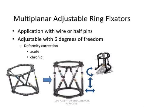 Principles Of External Fixator Ppt