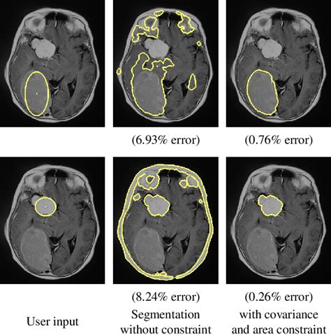 Figure 4 From A Convex Framework For Image Segmentation With Moment