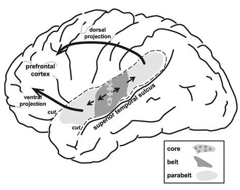 1 Human Auditory Cortex Modifi Ed From Hall And Barker 2012 Download Scientific Diagram