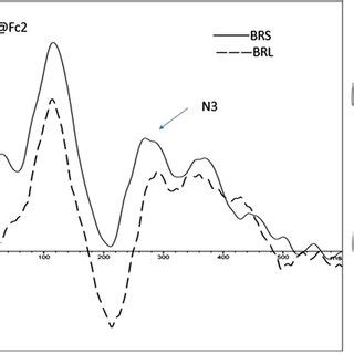 ERP Waveforms And Corresponding EEG Activation Patterns At The Fc2 Site Download Scientific
