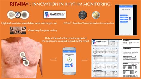 Heartsentinel Launches Ritmia An Automatic Arrhythmia Detection Tool — Movesense