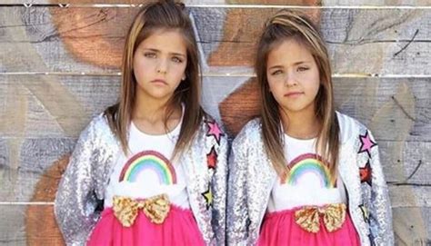 These Twins Were Named Most Beautiful In The World” Wait Till You See