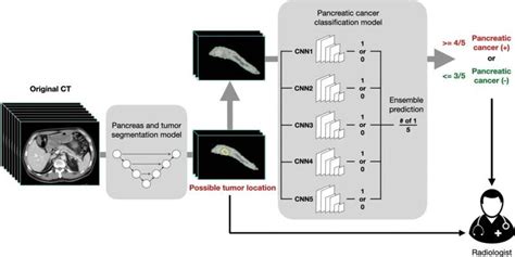 ai helps detect pancreatic cancer hale plus hearty