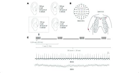 Overview Of The Stimulation Procedure During Concurrent Ecgeeg Download Scientific Diagram
