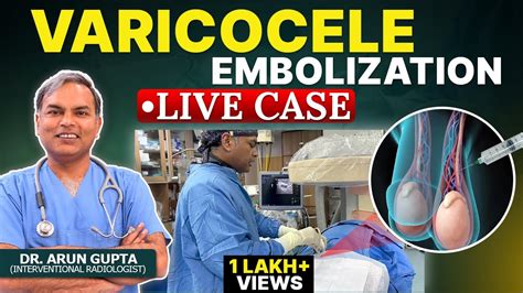 Live Case Grade 3 Varicocele Embolization Non Surgical Treatment Of Varicocele Dr Arun