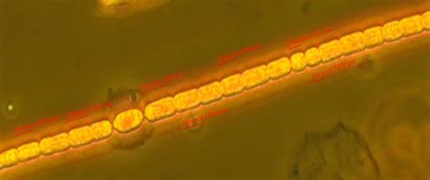 Cyanobacteria Identification Help﻿ A Slice Of Plankton