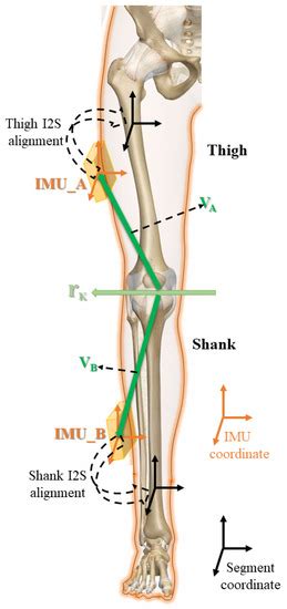 Effects Of Dynamic Imu To Segment Misalignment Error On 3 Dof Knee