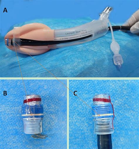 Technical Parameters Of Jea And Variceal Banding Kit Which Was Shot
