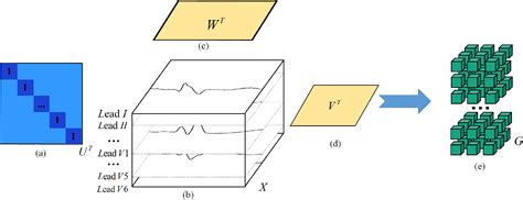 Figure 3 From Automated Localization Of Myocardial Infarction Of Image Based Multilead Ecg