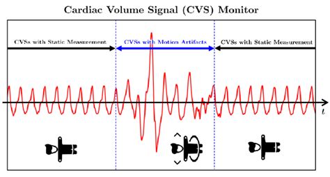 Motion Induced Artifacts In Cardiac Volume Monitoring Using Electrical Download Scientific