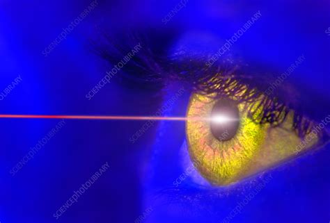 Retina Scan Stock Image T980 0240 Science Photo Library