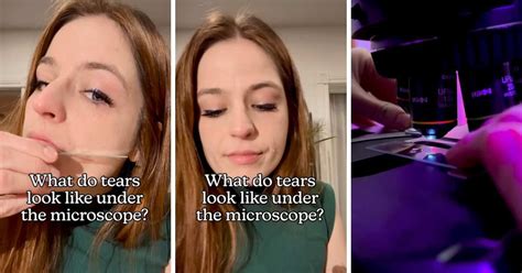 Microbiologist Observes Tears Under A Microscope And Its So
