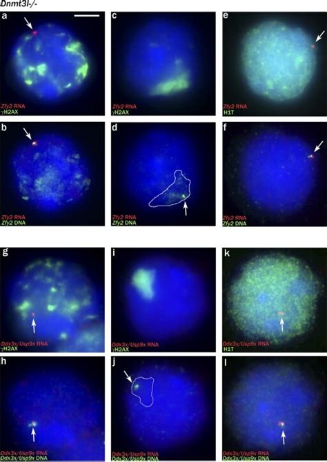 The Majority Of Dnmt3l Null Pachytene Spermatocytes Are Transcribing X