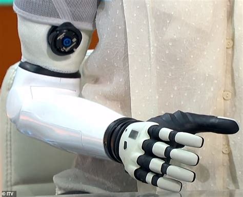 Worlds First Ai Bionic Mum Reveals What Life Is Like With Limb
