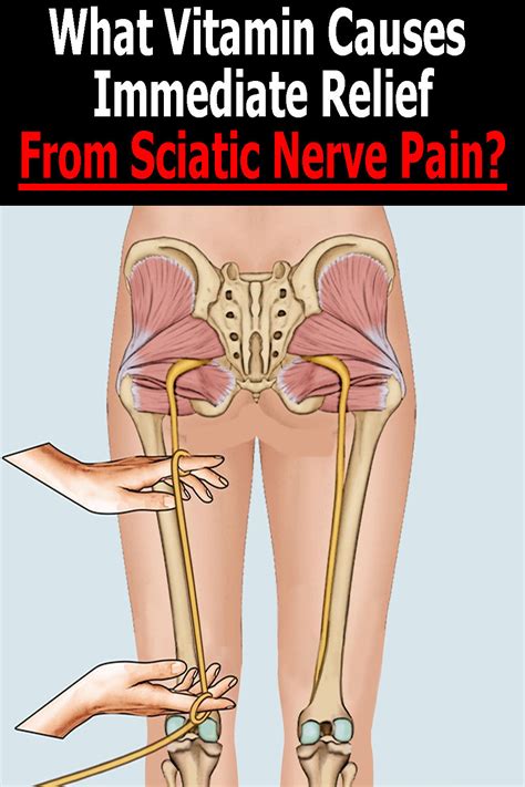 Sciatic Nerve Exercises Artofit