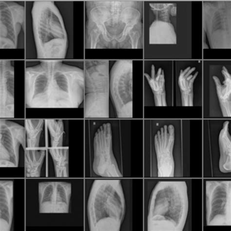 Unifesp X Ray Body Part Dicom Metadata Csv Kaggle
