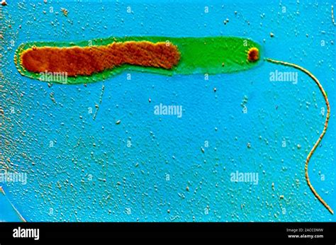 False Colour Transmission Electron Micrograph Of The Bacterium Vibrio Cholerae Gram Negative