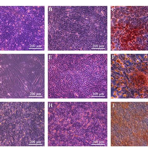 Osteogenic Differentiation Of Three Types Of Cells No Osteogenic Cells
