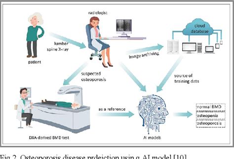 Figure 1 From An Advanced Deep Learning Approach For Primary Osteoporosis Prediction Using