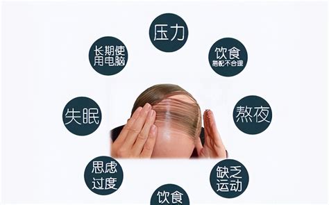 你掉的不是头发，是气血！一个仙方两味药，补血凉血，生发乌发 哔哩哔哩