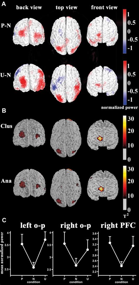 The Mlpp Arousal Modulation Is Localized To Right Prefrontal And Download Scientific Diagram