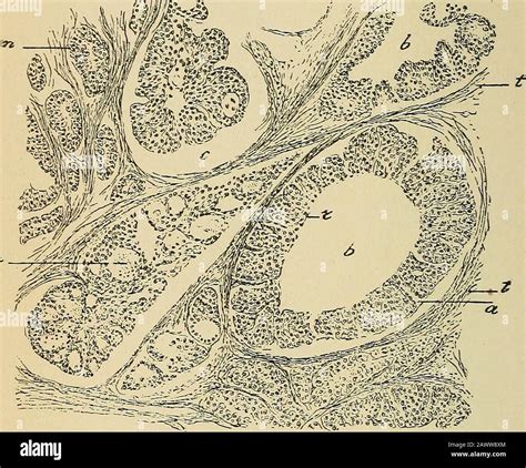 Treatise on gynæcology medical and surgical ial form peculiar to themucous membrane where