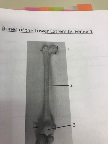 Lab 2 Bones Of Extremities Part 2 Flashcards Quizlet