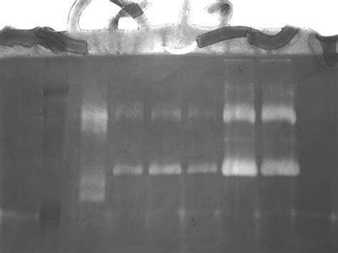 Zymography Gone Wrong So For The Last Two Months Ive Been Trying To Get A Decent Zymo Image