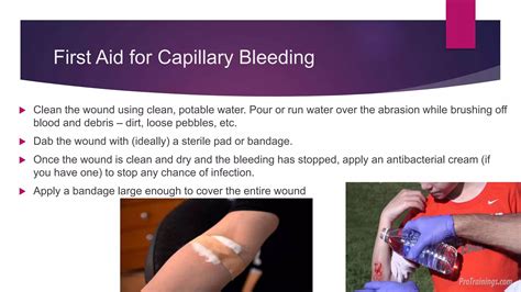 Types Of Bleeding Ppt Pptx
