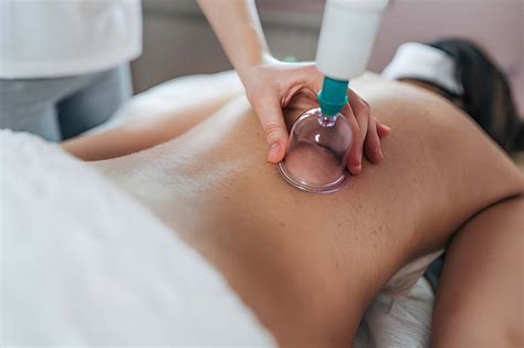 Cupping Vs Acupuncture Which Should You Book First Loong Wellness