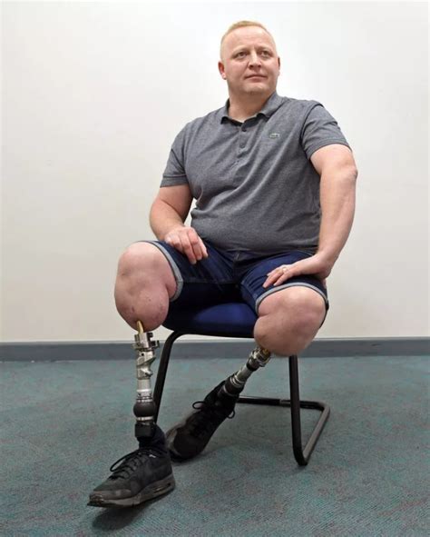 About Us Amputation Foundation