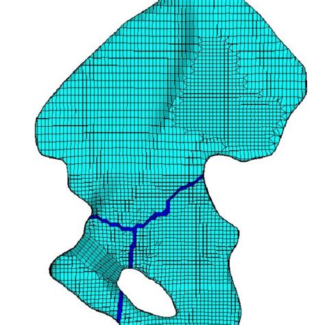 Finite Model Of Three Fixation Systems A Fracture Model Without