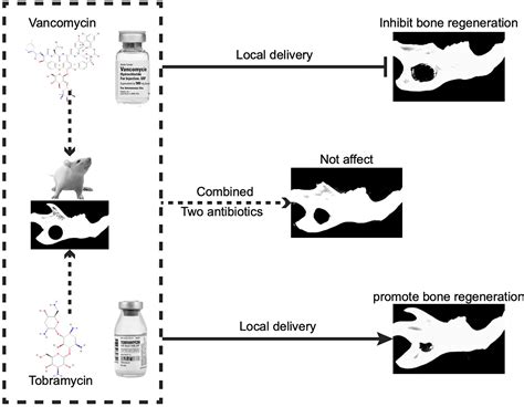Effect Of Local Delivery Of Vancomycin And Tobramycin On Bone