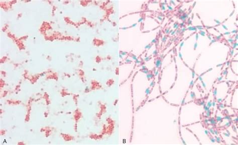 Micrococcus Luteus Acid Fast Stain