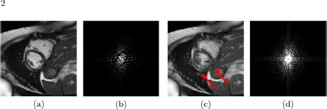 Pdf Cardiac Mr Motion Artefact Correction From K Space Using Deep Learning Based