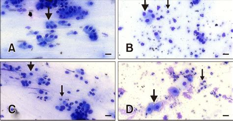 Microscopic Observation Of The Percentage Of Polymorphonuclear Download Scientific Diagram