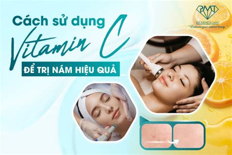 Cách sử dụng Vitamin C để trị nám hiệu quả PMT Aesthetic Clinic