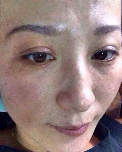 皮肤暗黄是什么原因引起的 你不懂就只有成黄脸婆了
