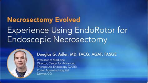 Dr Doug Adlers Experience Using Endorotor For Endoscopic Necrosectomy Youtube